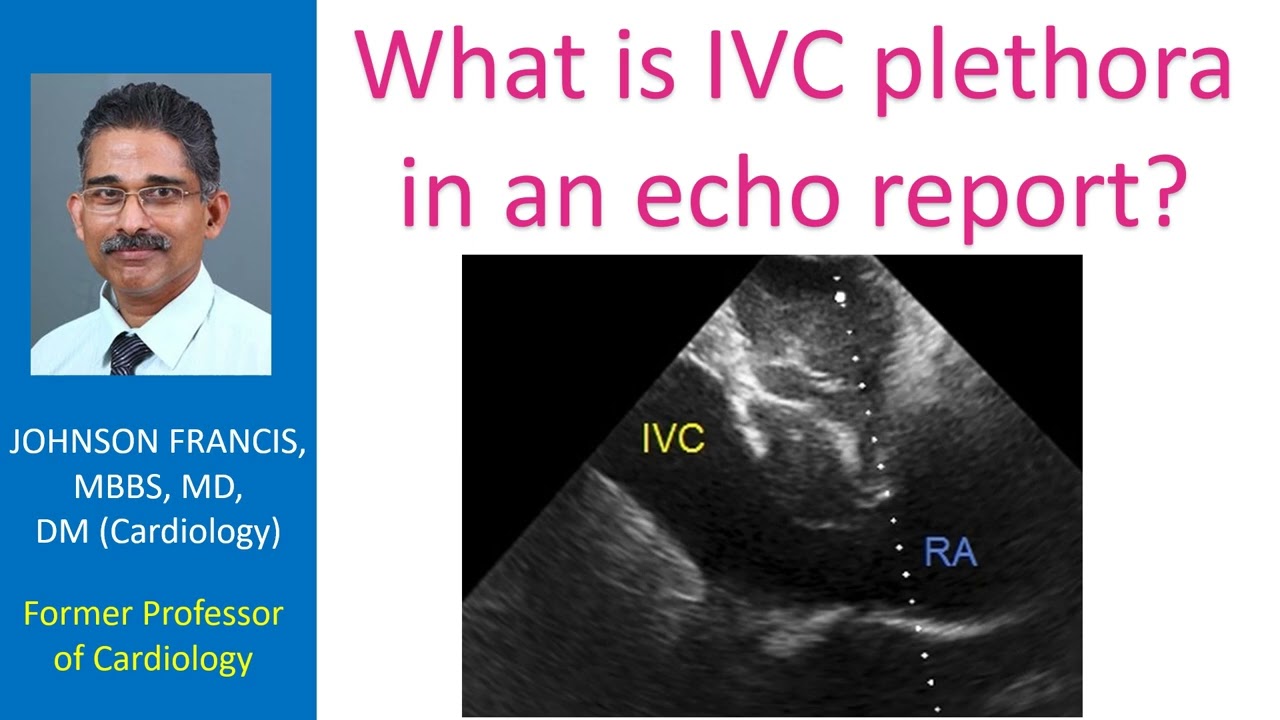 What is IVC plethora in an echo report? - YouTube what-is-ivc-plethora-in-an-echo-report-youtube