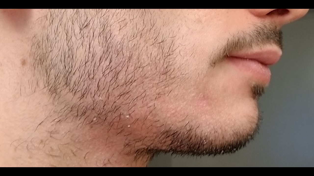GIMP Tutorial Creating A Thicker Fuller Beard YouTube GIMP Tutorial Creating A Thicker Fuller Beard YouTube