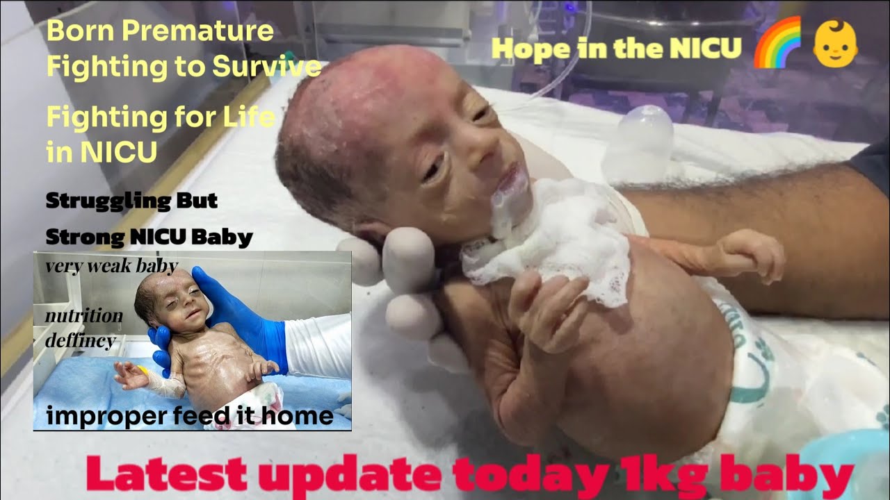 "1kg Premature Baby Latest Update | Slowly Improving"#cutebaby# ...