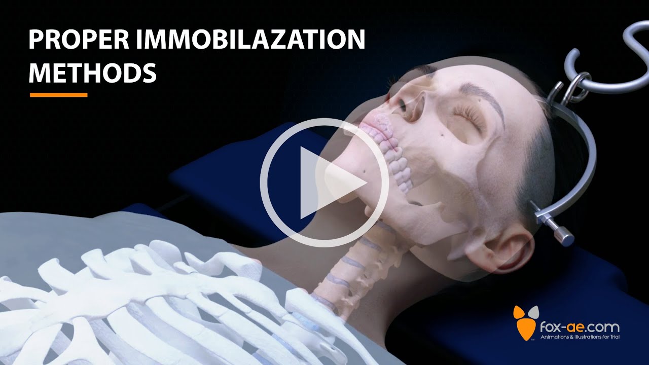 Proper Cervical Immobilization Method - YouTube