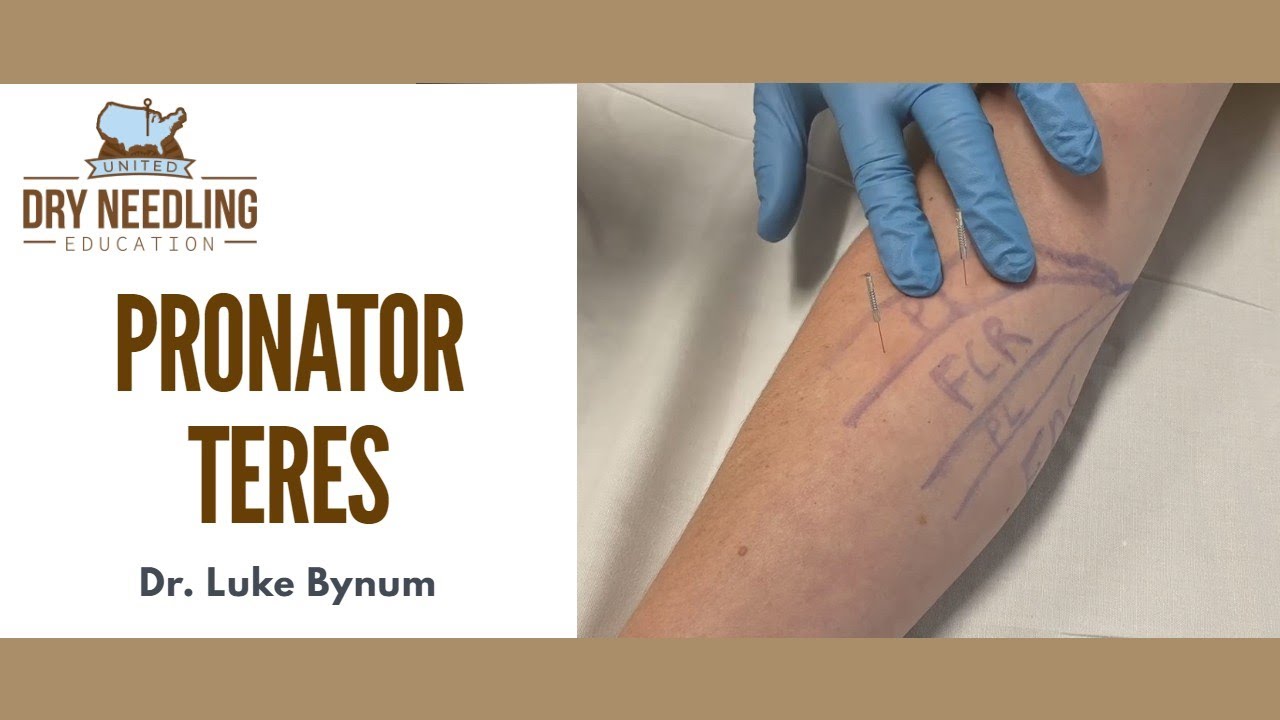 Dry Needling Pronator Teres - YouTube
