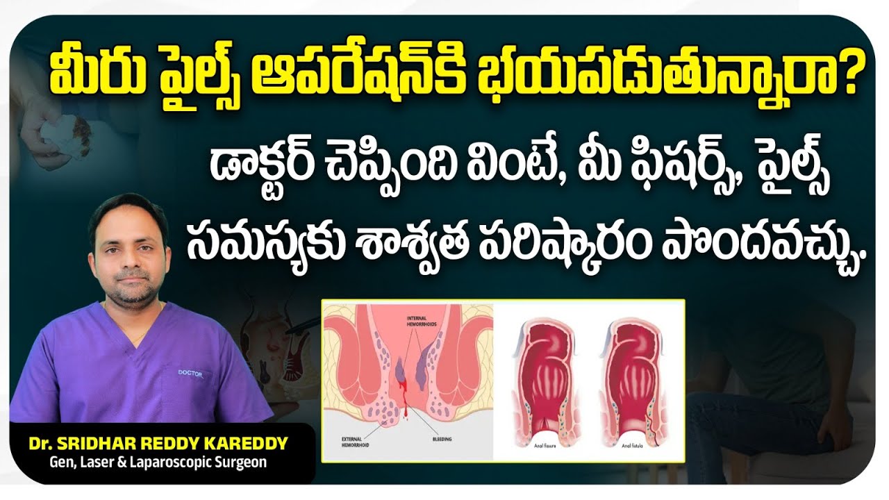 How to Cure Piles and Anal Fissures | What is the best medicine for ...