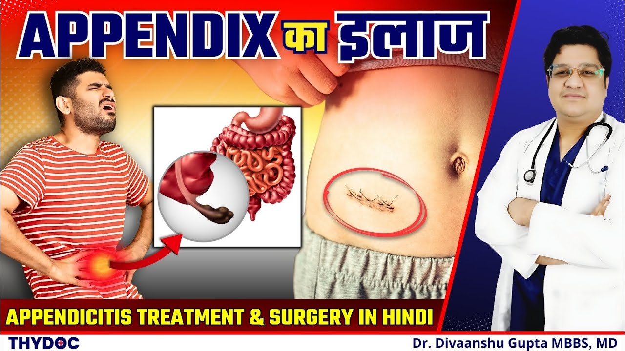 Appendix का इलाज कैसे होता है? अपेंडिक्स में सूजन Appendicitis ...