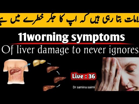Side effects of liver cirrhosis or liver damage, warning symptomجگر ...
