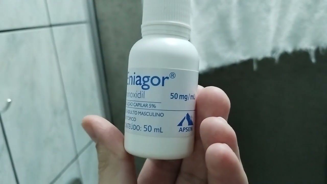 Minoxidil eniagor ótima opção. - YouTube