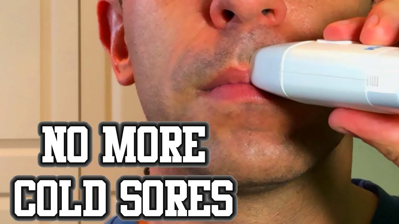 The only FDA Approved Electronic cold sore device - using Invisible ...