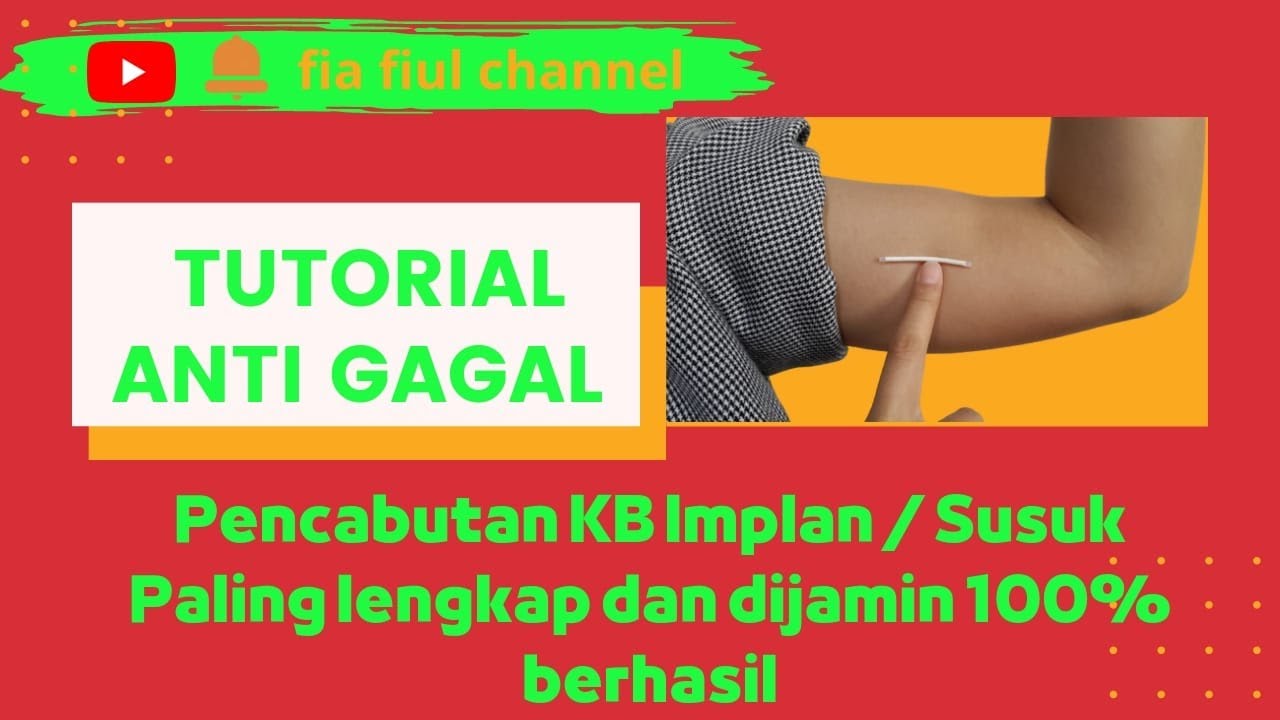 Pencabutan KB Implan/ Susuk gampang dan minim trauma|| Tutorial paling ...