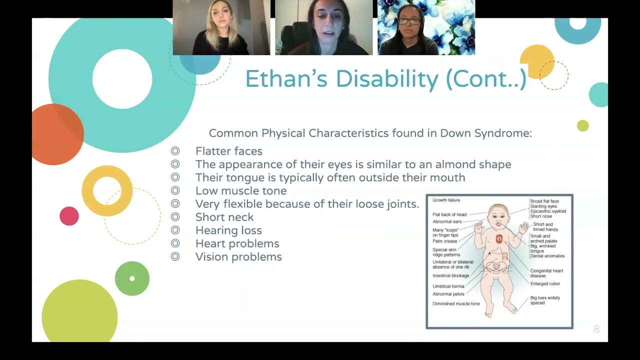SPED 431 Case Study: Down Syndrome - YouTube