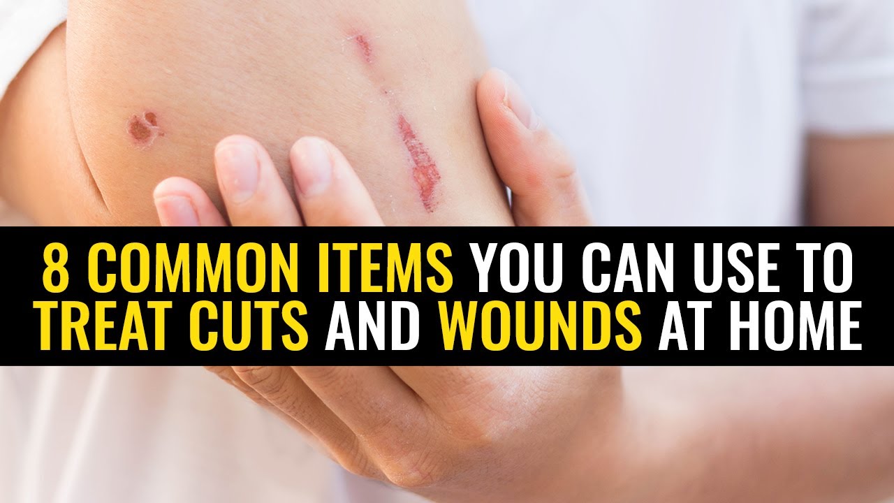 8 Common items you can use to treat cuts and wounds at home - YouTube