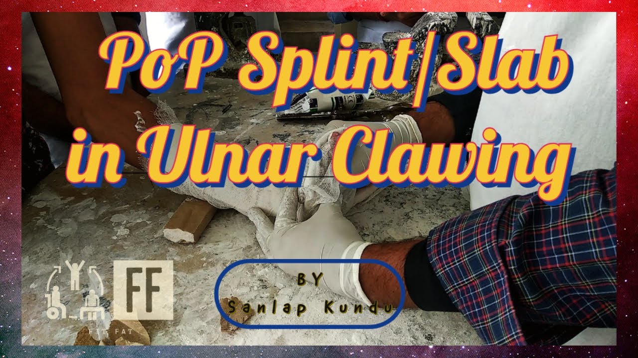 PoP splint/slab making in Ulnar Clawing/Ulnar nerve injury - Leprosy ...