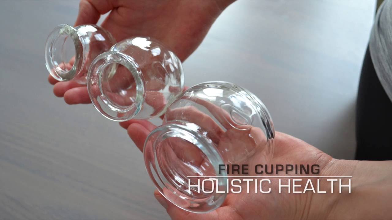 Refined Massage Therapy St Albert Myofascial Cupping Fire Cupping - YouTube