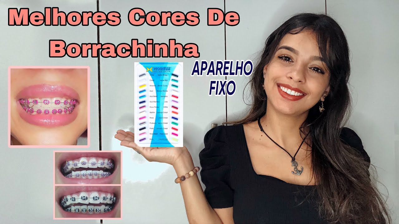 Melhores Cores de Borrachinha Para Aperelho Fixo!! Cores mais Bonitas. - YouTube