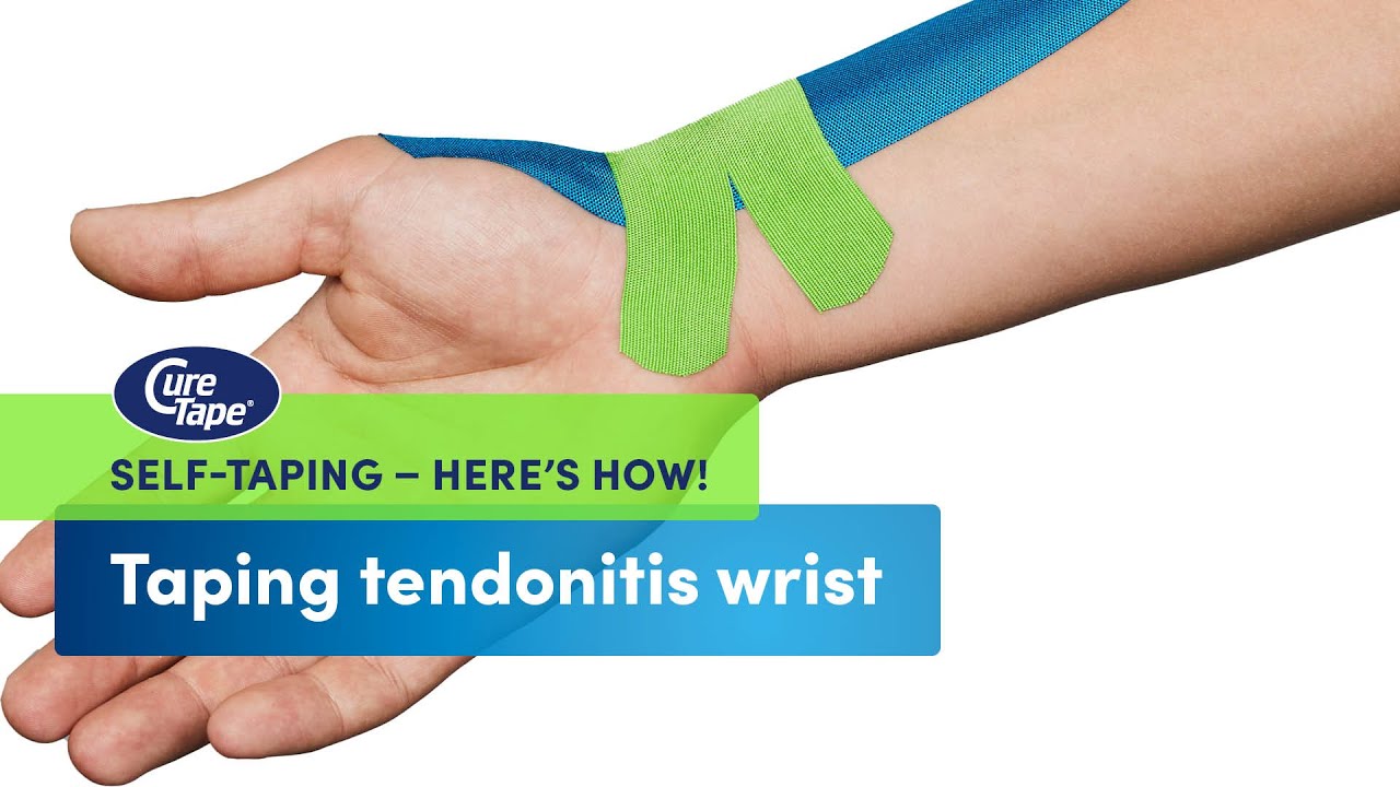 De Quervain’s Taping | Thumb-Side Wrist Pain Relief | Kinesiology ...