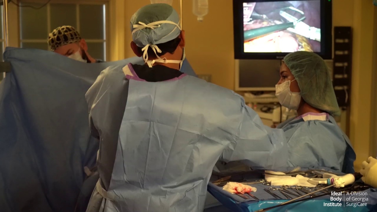 Real Surgery: Gastric Sleeve: Georgia SurgiCare: (9/12/19) - YouTube