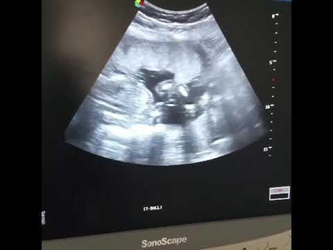 Kalbimdeki tek arzu, hayalimdeki tek tutku, beni yaşatan tek duygu senmişsin bebeğim♥♥