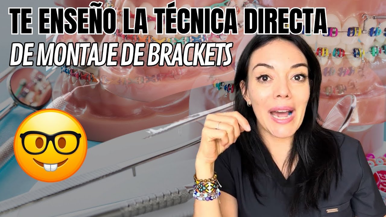 ORTODONCIA paso a paso, una explicación completa del montaje directo de ...