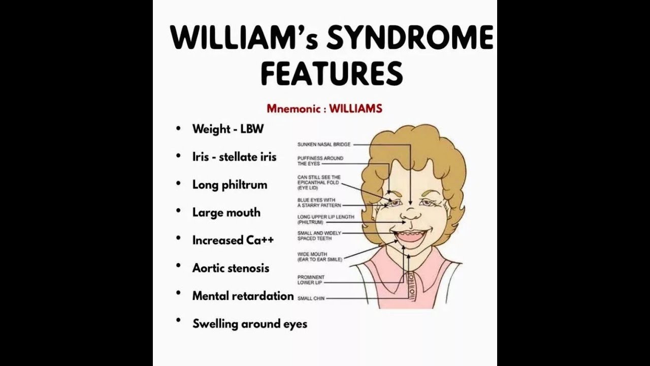 Williams Syndrome Symptoms Williams Syndrome: Mum's Struggle With