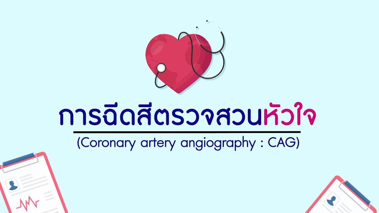 การฉีดสีตรวจสวนหัวใจ (Coronary artery angiography : CAG) - YouTube