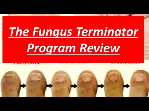 The Fungus Terminator Program Review *Do Not* Buy Before Watching This ...