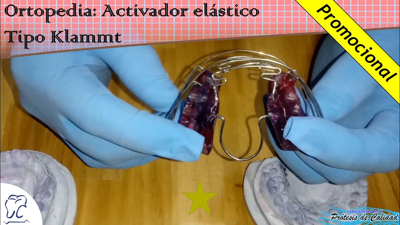 Protesis: Ortopedia - Activador Elástico Tipo Klammt - YouTube