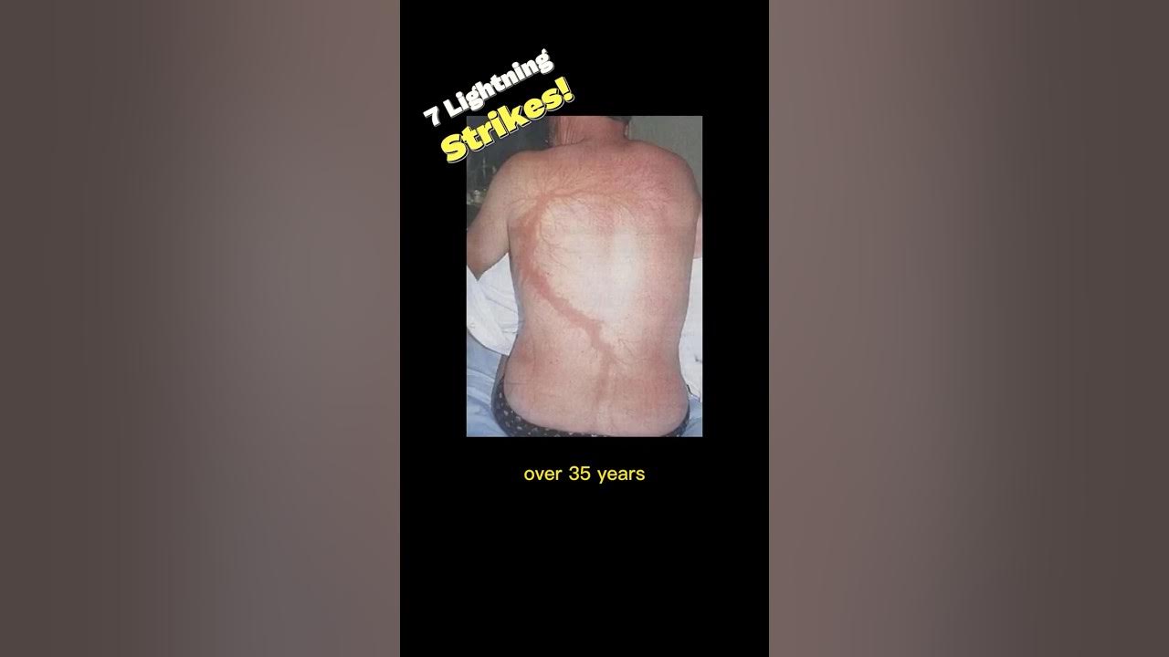 The Man Struck by Lightning 7 Times – The Unbelievable Story of Roy Sullivan! - YouTube