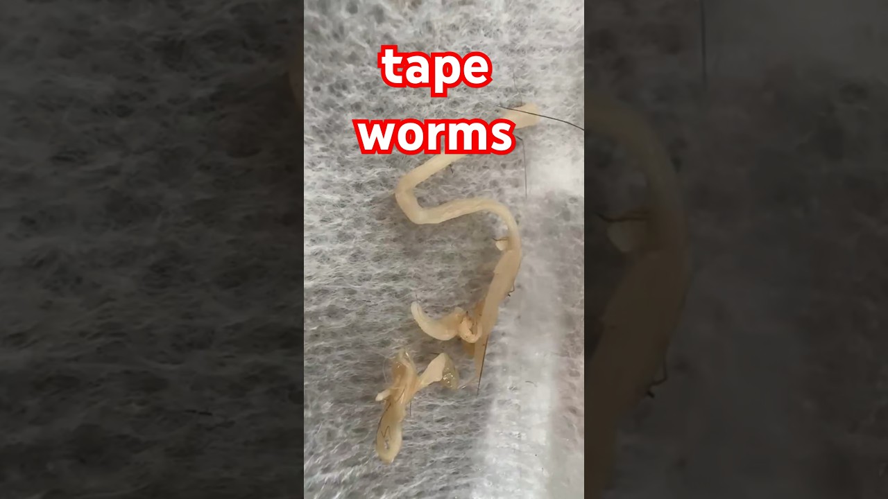 tape worms - YouTube