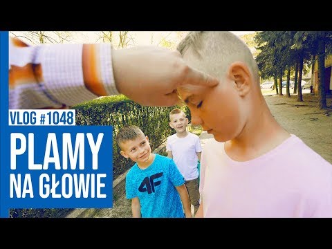 PLAMY NA GŁOWIE / VLOG #1048