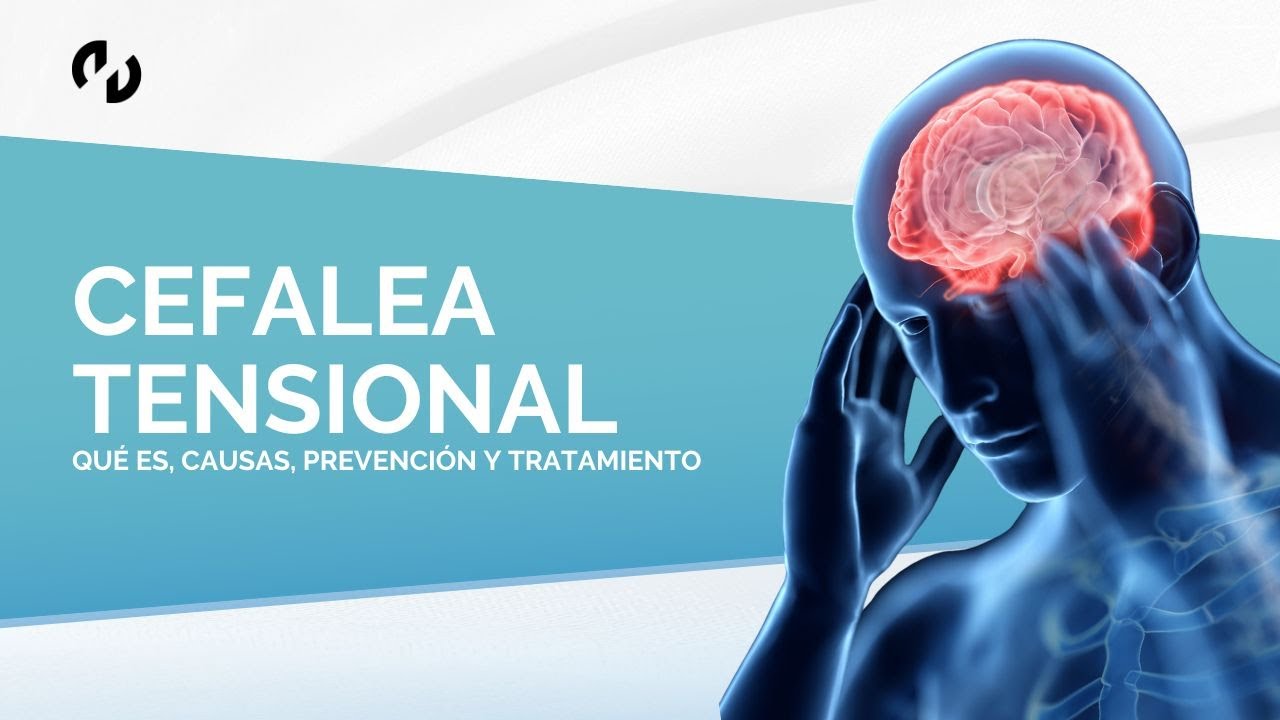 Cefalea tensional, qué es, causa, prevención y tratamiento - YouTube