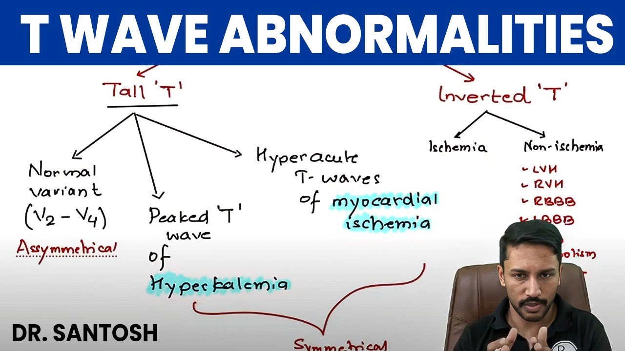 T Wave Abnormalities | Medicine | Master ECG Series with Dr. Santosh ...