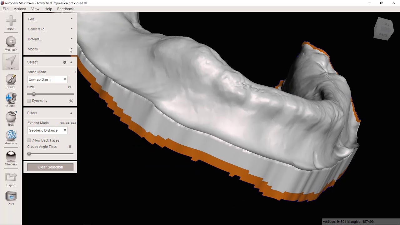 Creating a solid dental model for 3d printing - YouTube