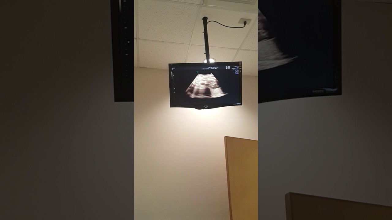 7 months pregnant ultrasound - YouTube
