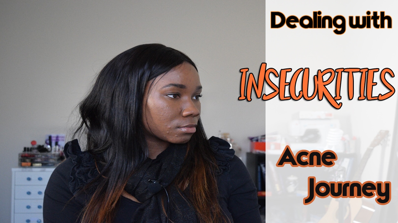How to Deal with Insecurities with Acne│Self Esteem Acne Journey│Living ...
