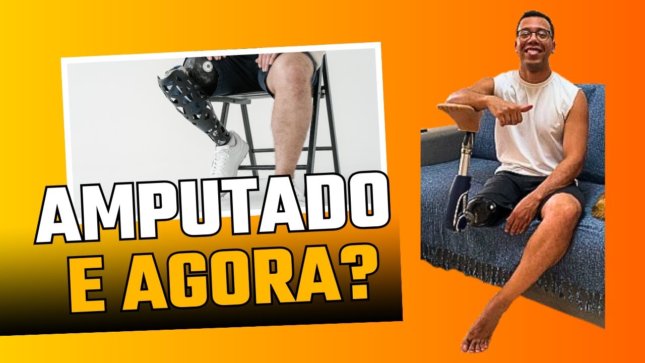 O Que Acontece Após uma Amputação? Minha Experiência Real | What ...