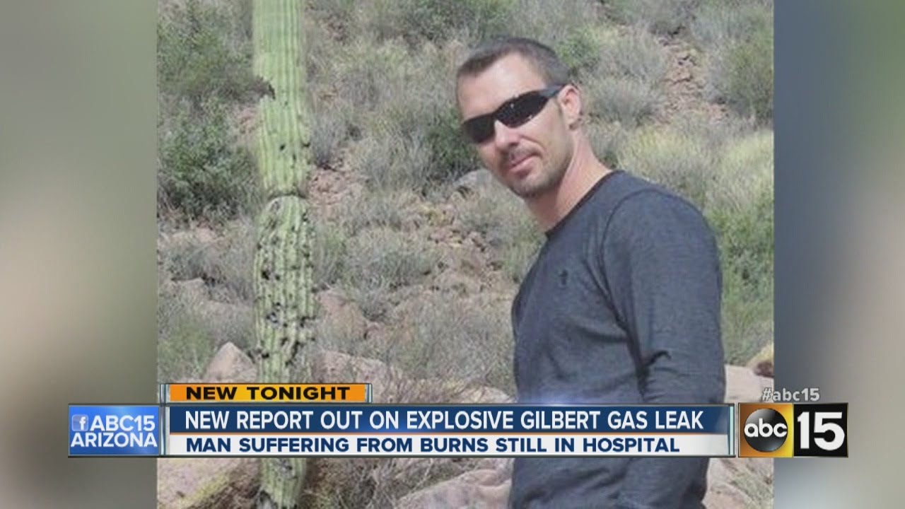 Man suffering burns over 80 percent of his body after Gilbert explosion ...