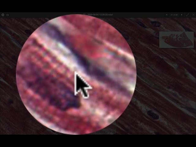 Skeletal Muscle Under Microscope