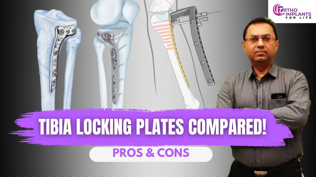 Proximal Tibia Locking Plates: A Comparative Surgical Insight - YouTube