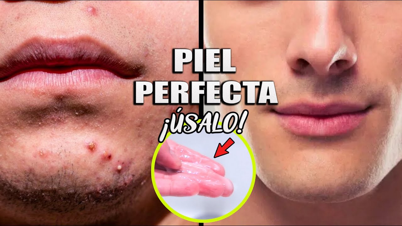CÓMO TENER PIEL CLARA Y PERFECTA RÁPIDAMENTE - YouTube