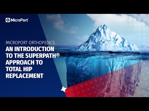 An Introduction to the SuperPath® Approach to Total Hip Replacement - YouTube