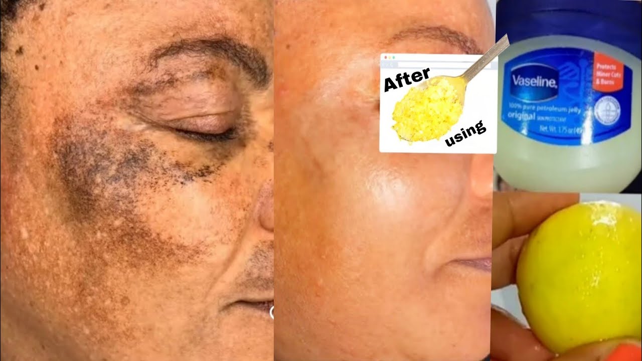 How to apply vaseline and lemon on face/ apply vaseline on your skin ...