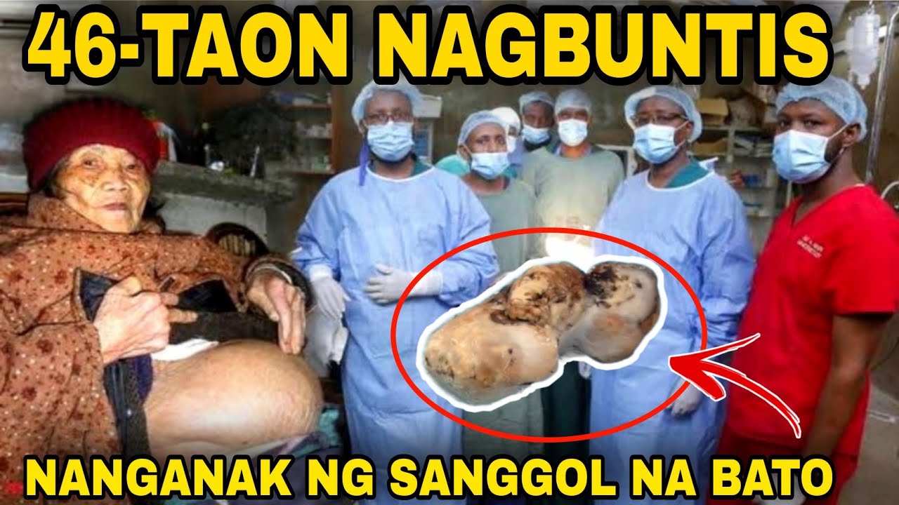 NAGULAT ANG MGA DOCTOR, Babaeng 46 TAONG BUNTIS, nanganak ng isang bato ...