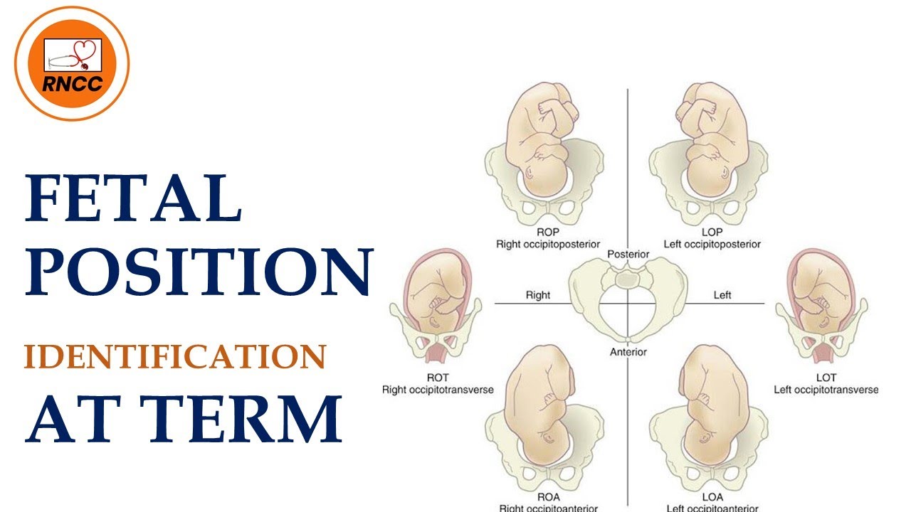 Fetal Position identification | fetal position |how to identify fetal ...