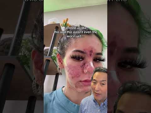 Can You Put Too Much Lotion On Your Hands