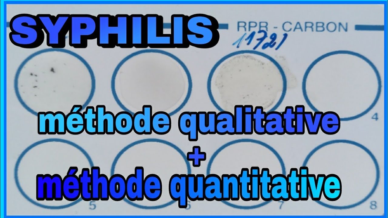 Syphilis | RPR-Carbon - Méthodes Qualitative et Semi-Quantitative - YouTube