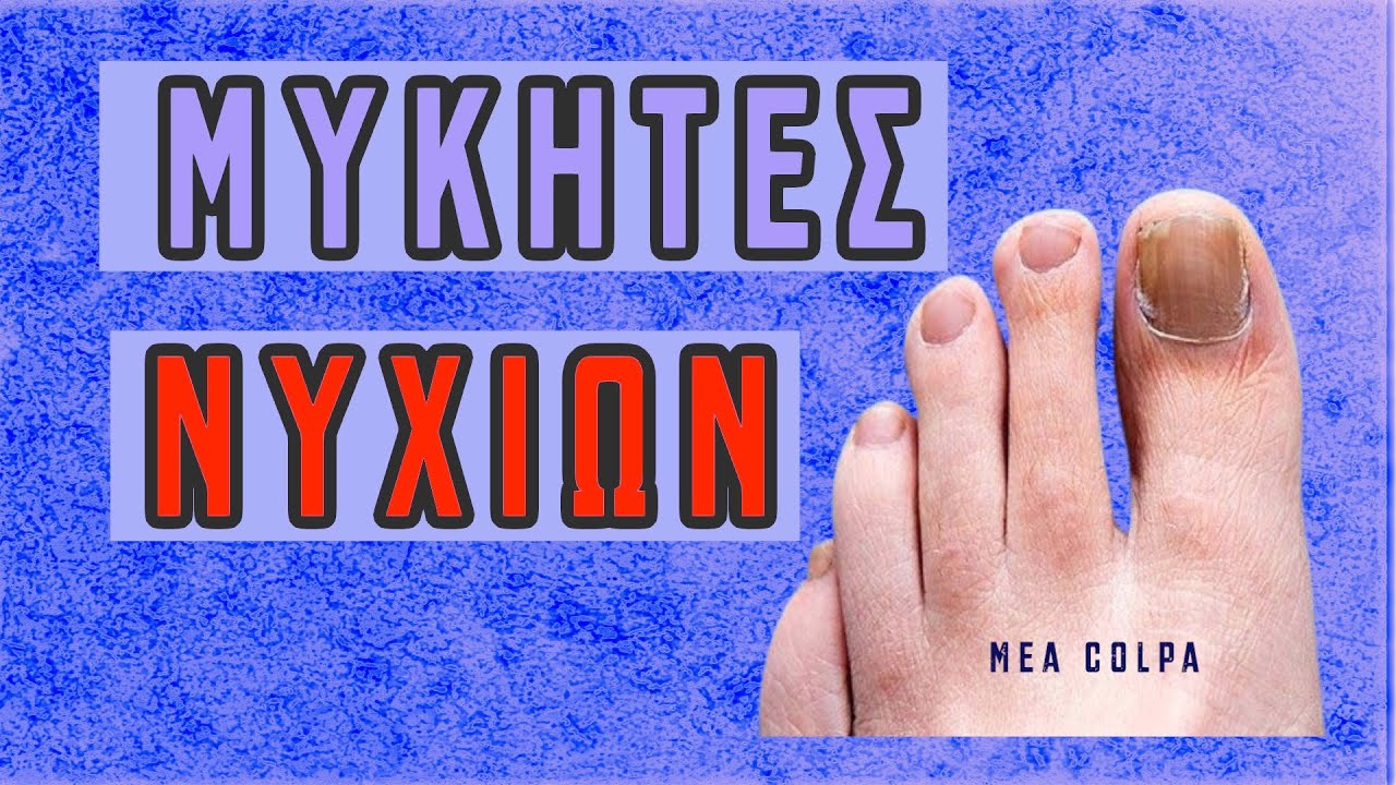 Μύκητες Νυχιών 12 Σπιτικές Θεραπείες - YouTube
