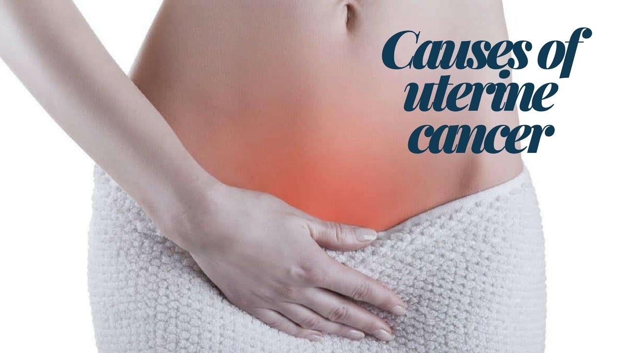 CAUSES OF UTERINE CANCER YouTube causes-of-uterine-cancer-youtube