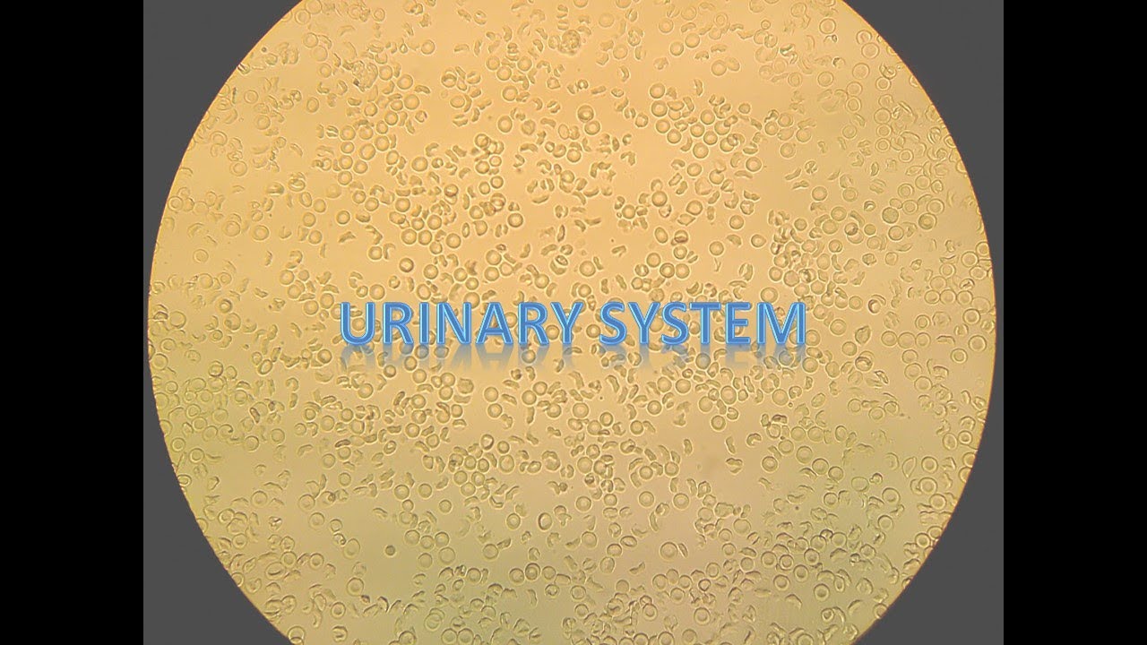 Medical Terminology Pathology of the Urinary System - YouTube