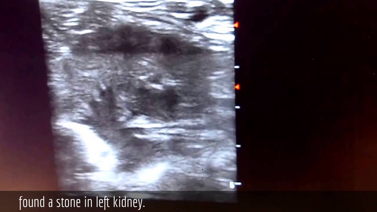 Ultra sound scans of kidneys and cystoscopy of 7 year old mare with ...