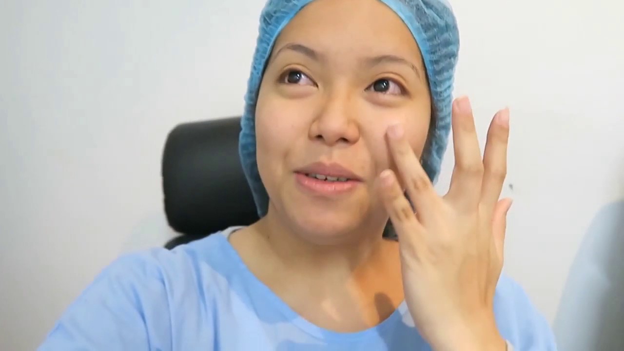 Say Tioco Gets Z Prime LASIK Surgery | Shinagawa Philippines - YouTube