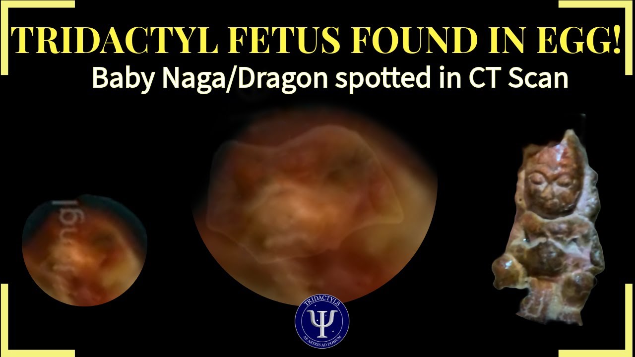 Tridactyl Fetus in Egg of Artemis: The Real Pig Dragons - YouTube