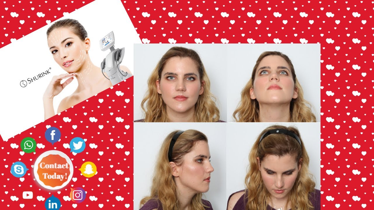 Shurink Skin Laser Treatment & Experience in South Korea | Hifu ...